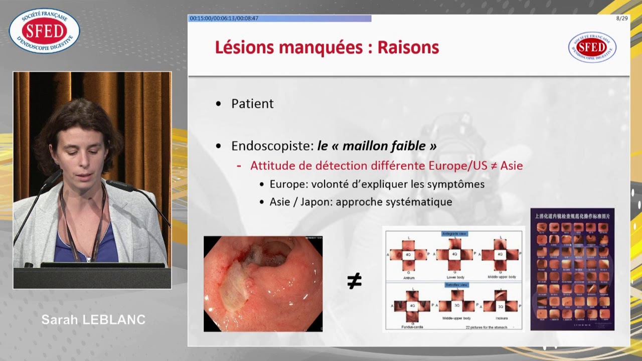 La qualité en œso-gastro-duodénoscopie (vidéo) – SFED