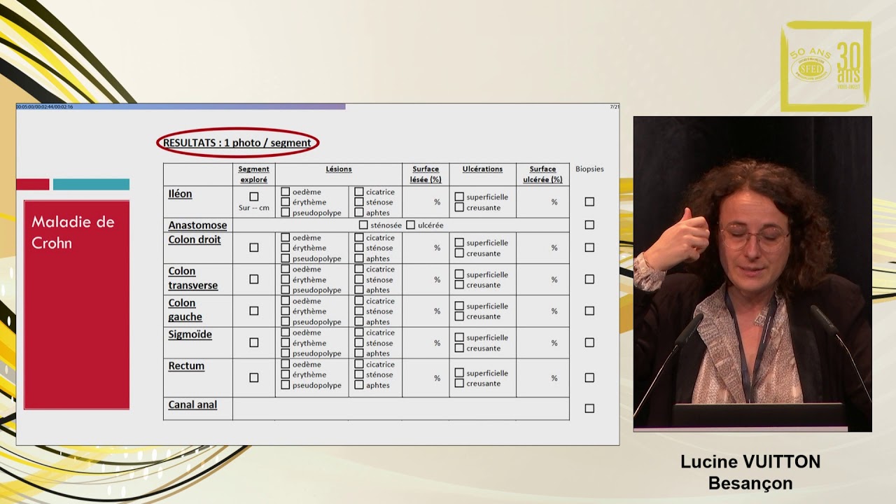 Le compte-rendu d'endoscopie type dans les MICI (vidéo) – SFED
