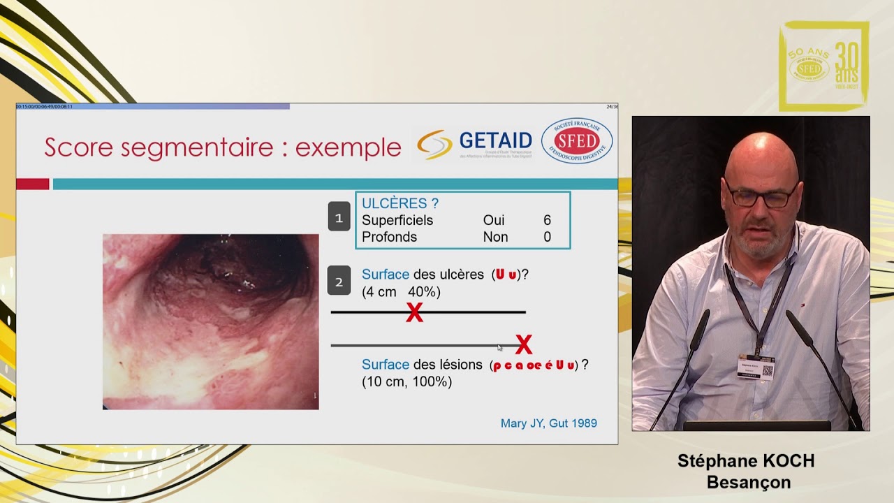 L'endoscopie pour la maladie de Crohn (vidéo) – SFED