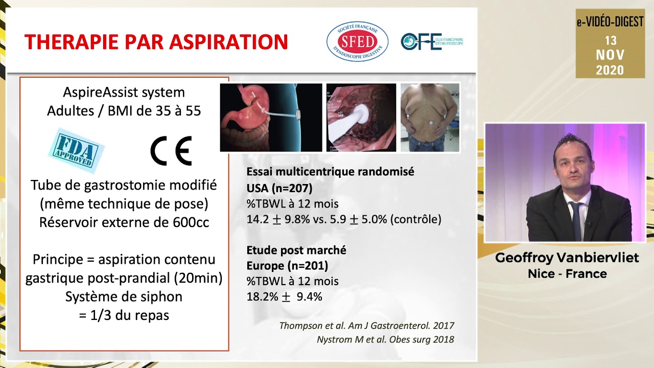 Symposium professionnel "Actualités en endoscopie digestive" (vidéo) – SFED