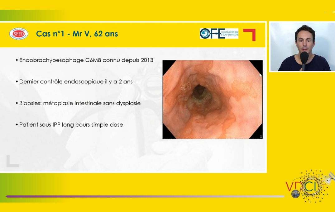LIVE VIDEO DIGEST 2023 - Examen Endobrachyoesophage – SFED