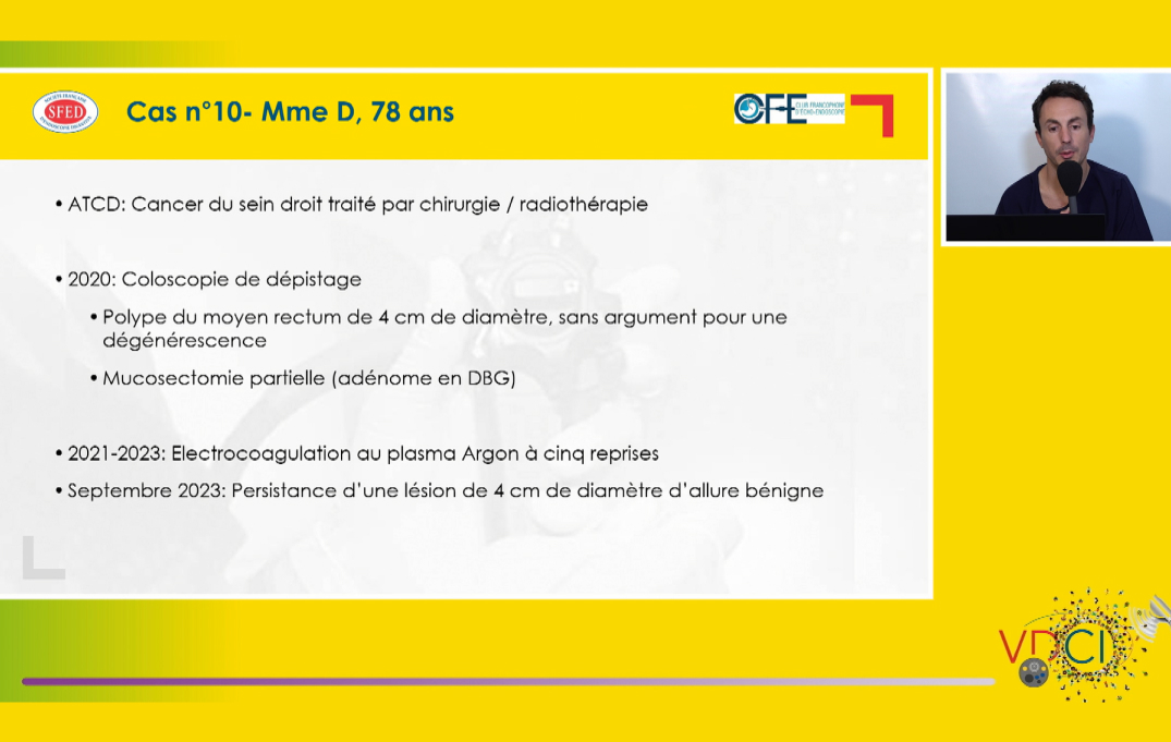 Différé Vidéo-digest 2023 : Démonstrations d'endoscopie digestive ...