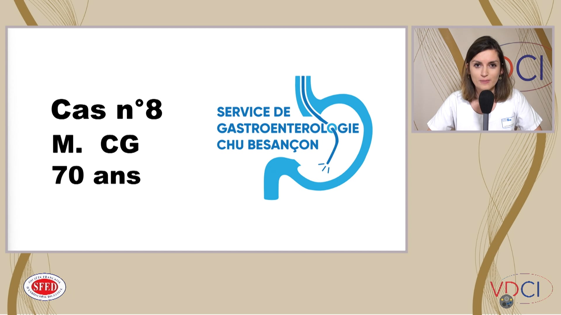 Live Vidéo-Digest 2024 : Gastroscopie EBO DHG Duette / ESD – SFED